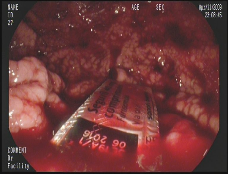 Restos Hemáticos: Un Tema Vital en Medicina